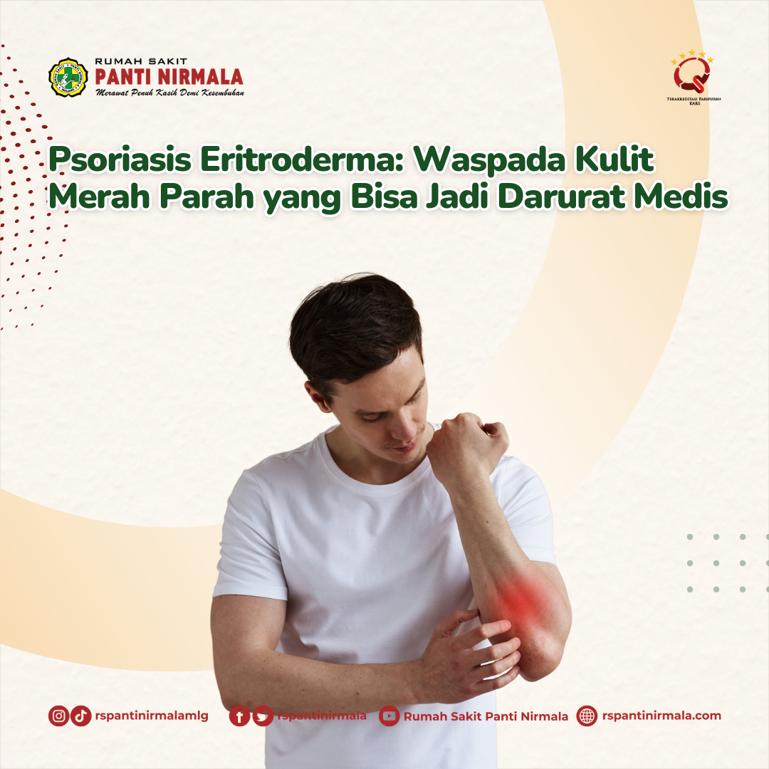 Psoriasis Eritroderma: Waspada Kulit Merah Parah Yang Bisa Jadi Darurat ...
